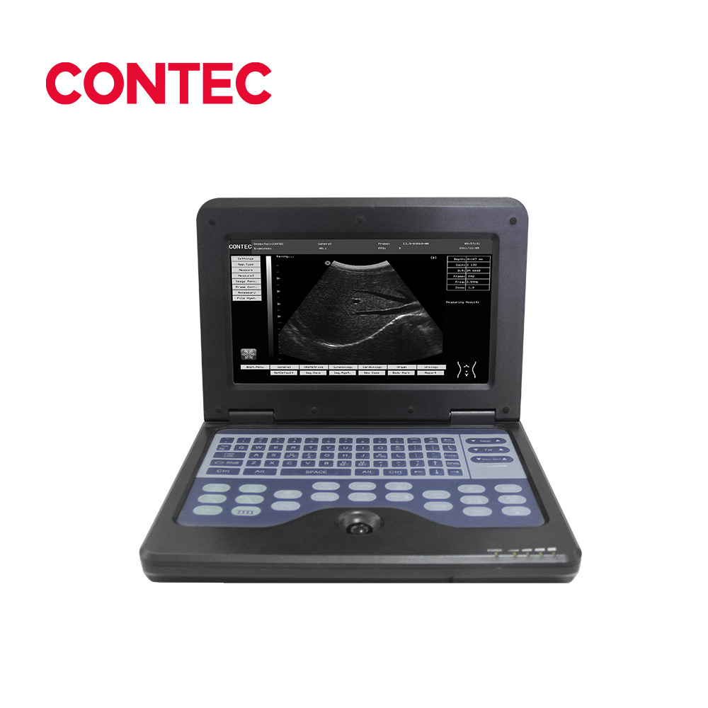 CONTEC CMS600P2 10.1" Digital Cheap Notebook Portable B-Ultrasound Machine