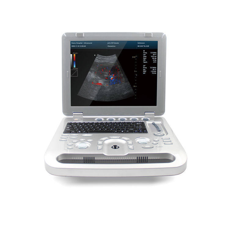 Telemedicine,Patient Monitor,ECG Monitor-Contec medical systems