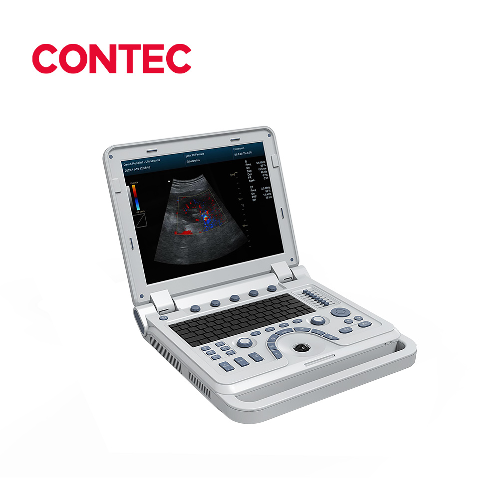 CONTEC CMS1700B Color Doppler Ultrasonic Diagnostic Device B-Ultrasound