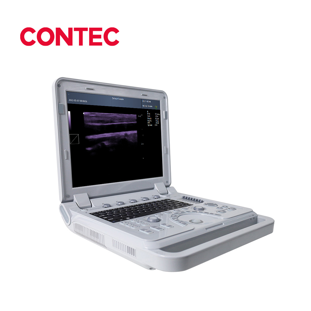 CONTEC CMS600P2plus Pseudo Color Doppler Ultrasound Machine | Pulse ...