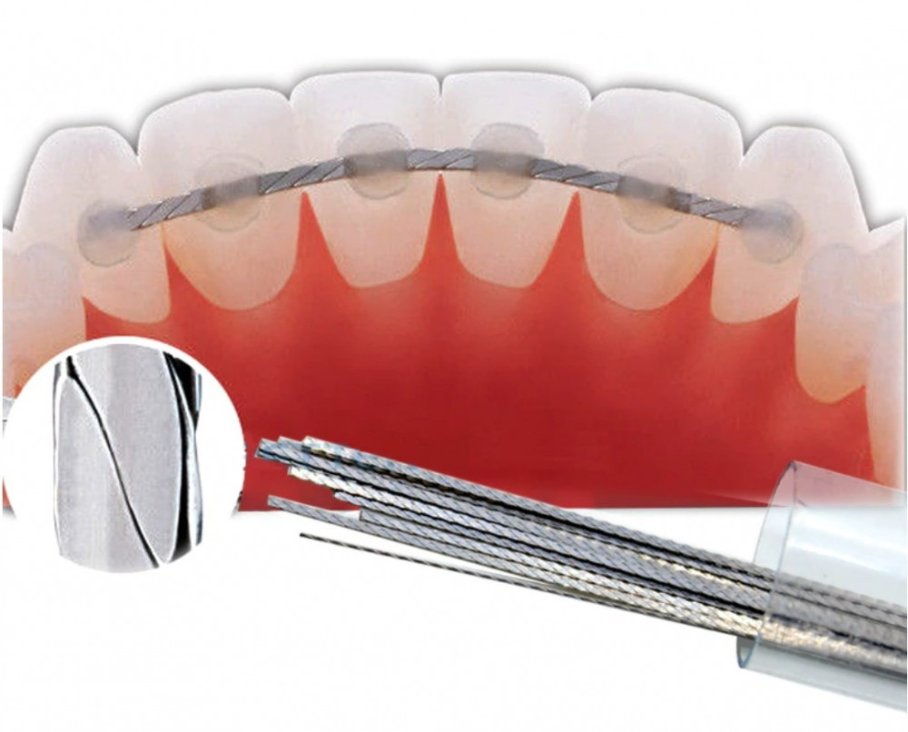 Lingual Retainer Wire--