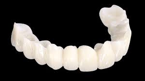 Temporary Crown/Bridge-Glisten