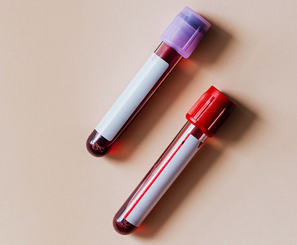 RFID Test Tube Labels for Efficient Biological Sample Identification ...