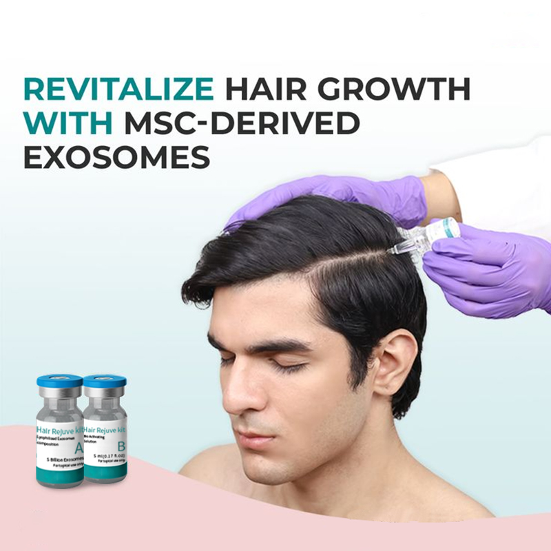 Custom Logo Strengthening Regrowth Oil Exosome for Hair Growth Serum ...