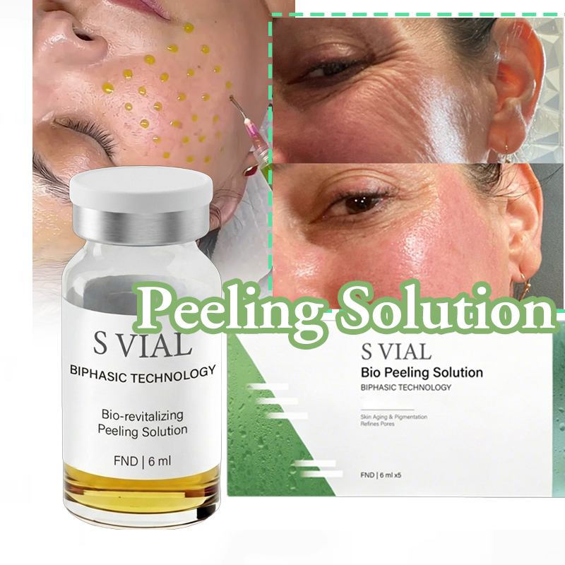 TCA Chemical Peel Serum: Clear Acne Scar, Improve Texture, No Side ...